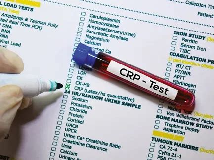 Book CRP Test At Affordable Prices OFF Home Collection