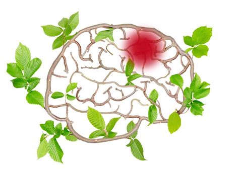 Laci 2 Sets Stage For Cilostazol Isosorbide Combo In Lacunar Stroke