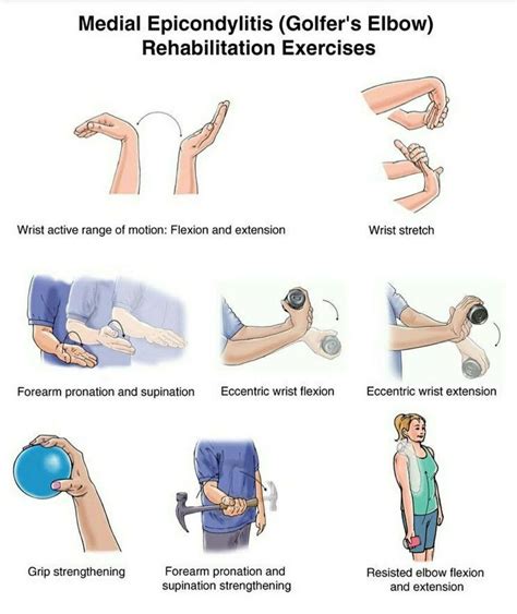 Medial Epicondylitis Golfers Elbow Exercises Forget Me Knot