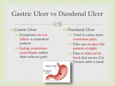 Drknowledge Duodenal Ulcer Vs Peptic Ulcer