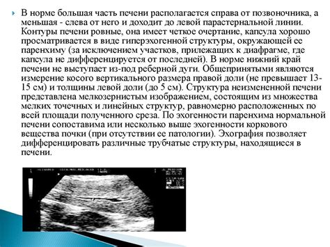 Ультразвуковое исследование органов брюшной полости презентация онлайн