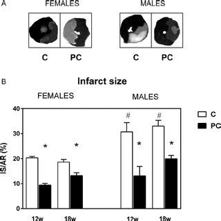 Effects Of Sex And Aging On The Size Of Myocardial Infarction In The Download Scientific