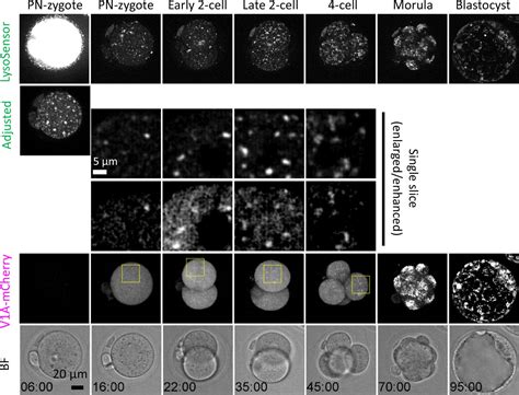 Endosomal Lysosomal Organellar Assembly Elysa Structures Coordinate