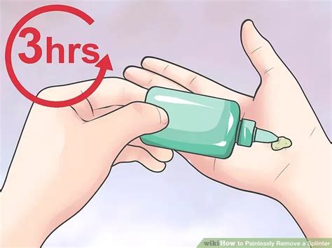 Best 13 How To Remove A Splinter Artofit