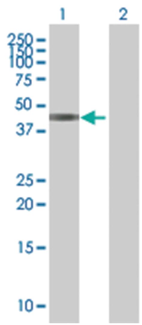 Tcf19 293t Cell Overexpression Lysate Denatured Abnova 100μl Protein