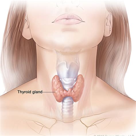 Hyperthyroidism Overactive Thyroid Niddk