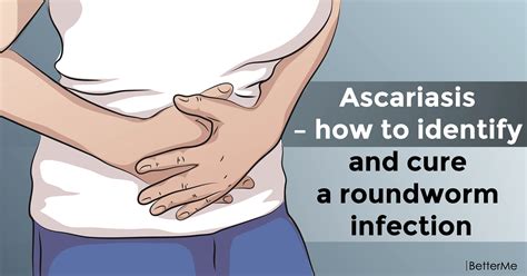 Ascariasis Symptoms
