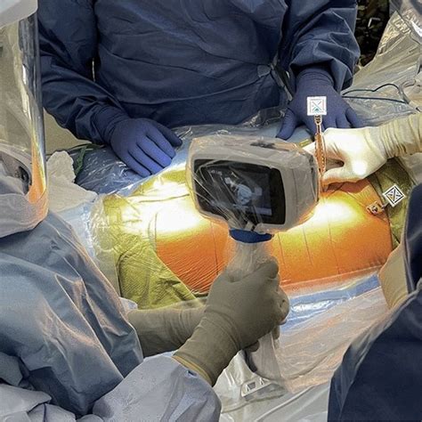 Cartesian Plot Displaying Variations In Radiographic Measurements Of Download Scientific