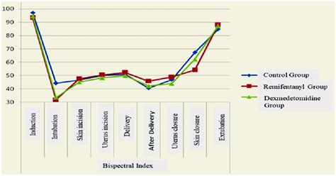 Bispectral Index Values Of The Groups Mean Ae Sd Download