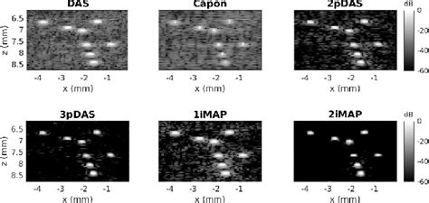 Figure 1 From Microbubble Detection With Adaptive Beamforming For Ultrasound Localization