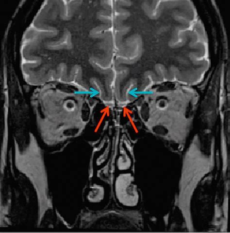 Olfactory Function And Dysfunction Clinical Tree