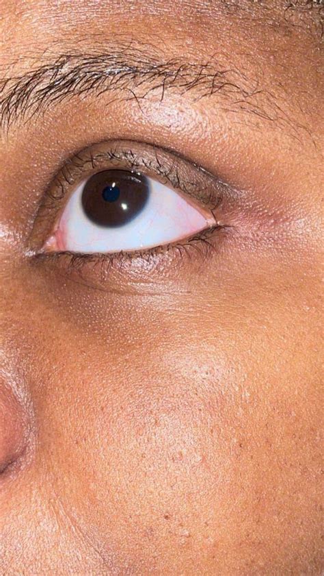 Progress 😛 Rtrichotillomania