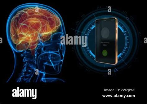 4k 60 Fps 3d Animation X Ray Human Head Moving With Ringing Incoming