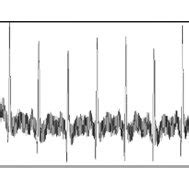 Notch Filter Effect A Before The Filtering B After The Filtering Download Scientific