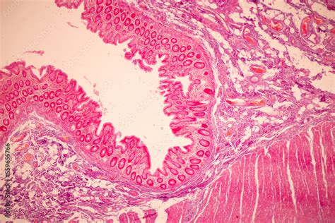 Tissue Of Small Intestine Duodenum Large Intestine Human And Stomach Human Under The