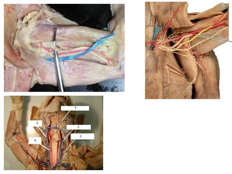 Peripheral Nervous System Diagram Quizlet