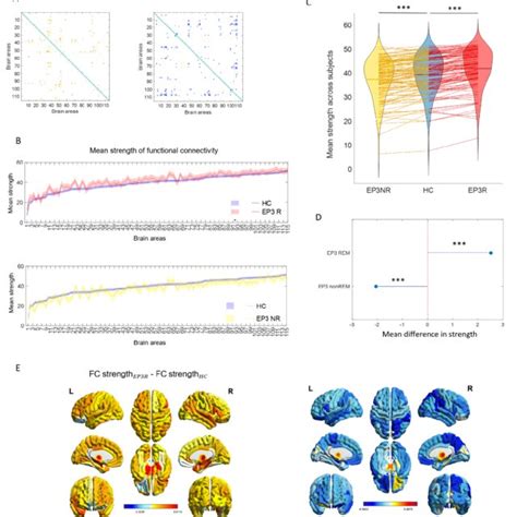 Empirical Functional Connectivity Alterations A Differences In Group Download Scientific