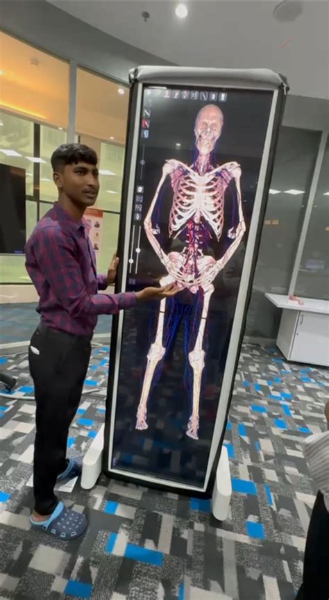 Medicalinnovation Roboticsinmedicine Biomedicalengineering Devika