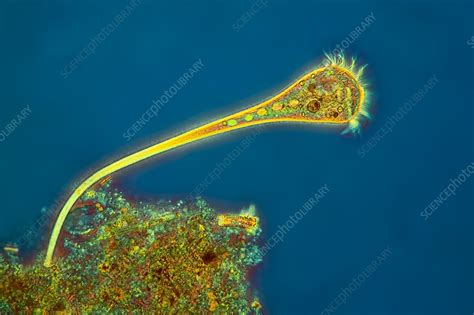 Stentor Protozoan Light Micrograph Stock Image C0461511 Science