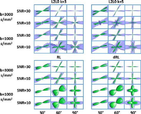 Figure 1 From Quantitative Comparison Of Spherical Deconvolution Approaches To Resolve Complex