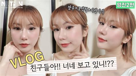 무쌍이 매력이라고 성형 반대하던 친구들아 봐라 쌍꺼풀수술 매부리코수술 지방이식하고 내 얼굴 만족도 업 💗 Youtube