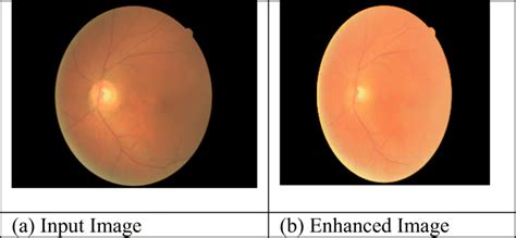 a input image b enhanced image download scientific diagram