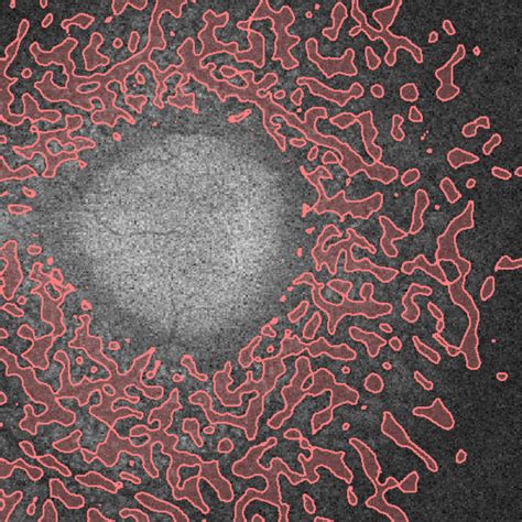 Ophthalmic Image Analysis Iowa Institute For Biomedical Imaging The University Of Iowa