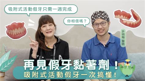 再見假牙黏著劑吸附式活動假牙一次搞懂吸附式活動假牙只需一週完成你相信嗎栩悅牙醫許明翰醫師 活動假牙 吸附性活動假牙 假牙