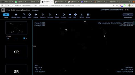 Example Of Using The OHIF Viewer To View A DICOM File Issue OHIF Viewers GitHub