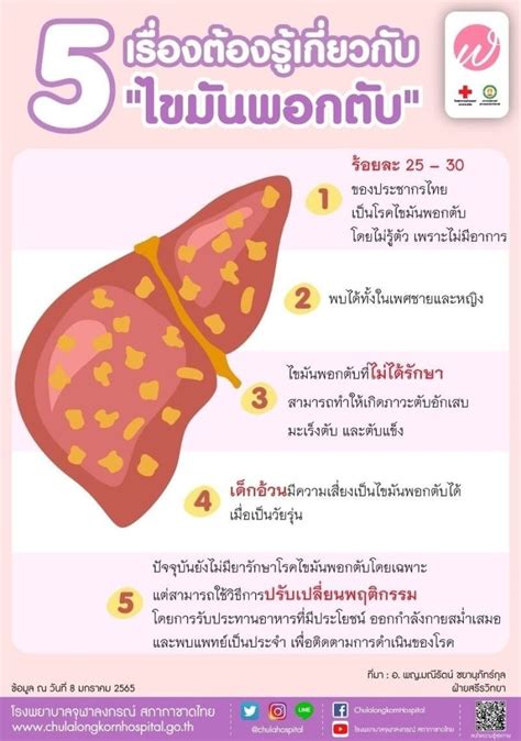 5เรื่องควรรู้เกี่ยวกับไขมันพอกตับ คลิ๊กฟังคุณหมอแนะนำ Youtube