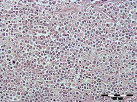 Histiocytic Cells With Irregular Mitotic Figures Collagenic Fibres A Download Scientific