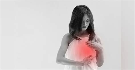 Molecular Testing Supports Early Effective Use Of Esr1 Targeting Therapies Medical Laboratory