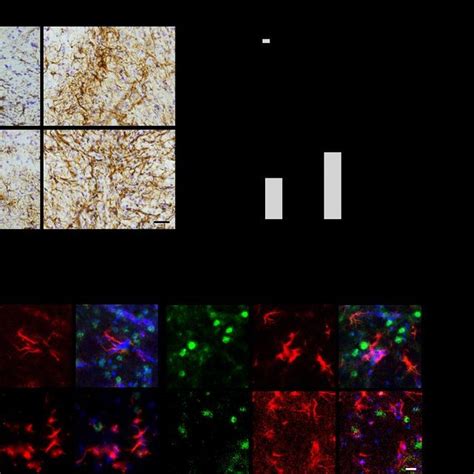Fig S3 αsyn Induced Astrogliosis And Nrf2 Expression In Astrocytes Download Scientific