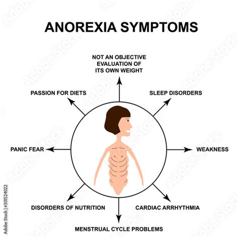 Anorexia Symptoms Slim Physique With Anorexia Infographics Vector Illustration On Isolated