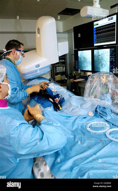 Coronary Angioplasty Surgical Team Performing A Coronary Angioplasty Procedure On A 50 Year Old