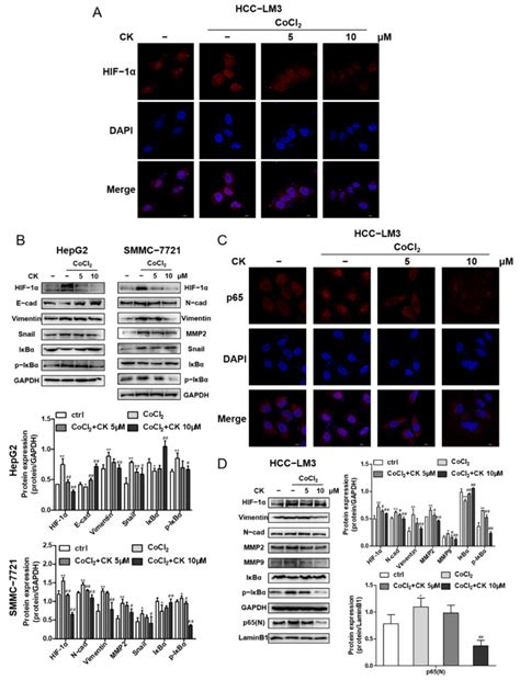 Ginsenoside Ck Inhibits Hypoxia Induced Epithelialmesenchymal