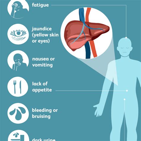 Hepatitis E Symptoms