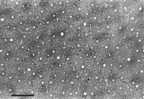 The Locations Of Labelled Cells In Layer 4b Of Macaque Striate Cortex