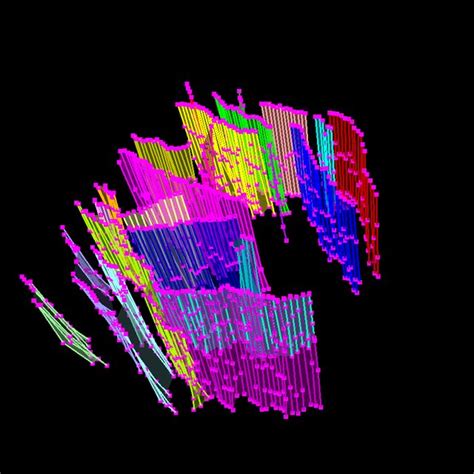 Three Dimensional Display Of Fault Distribution In The Abdominal Area Download Scientific