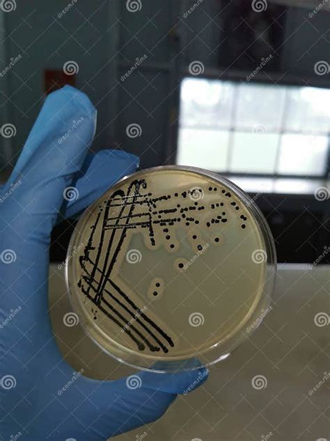 Staphylococcus Aureus On Baird Parker Agar Stock Image Image Of Condition Bacterium 298503685