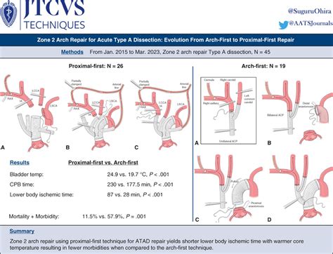 Zone 2 Arch Repair For Acute Type A Dissection Evolution From Arch