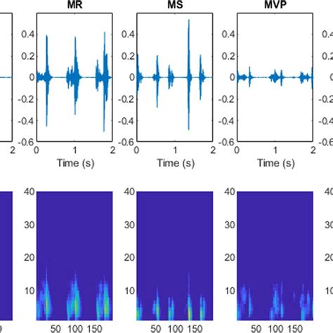 Confusion Matrices Of Cnn Models Download Scientific Diagram