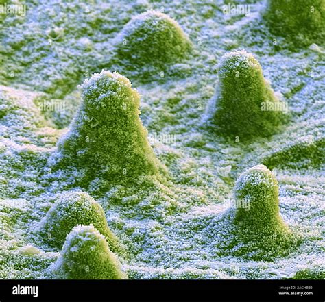 Lotus Leaf Surface Coloured Scanning Electron Micrograph Sem Showing The Microstructures On