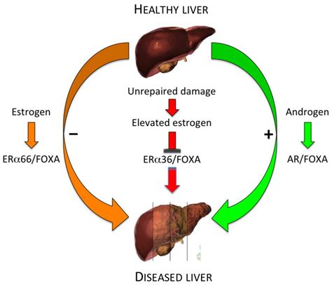 Estrogens In Hepatocellular Carcinoma Friends Or Foes