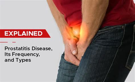 Prostatitis Disease Its Frequency And Types Psri Hospital