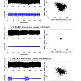 Examples Of AF Recordings Screening Download Scientific Diagram