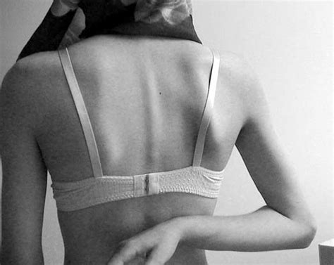 When The Patient S Right Arm Was Positioned In Flexion At Elbow And Download Scientific Diagram