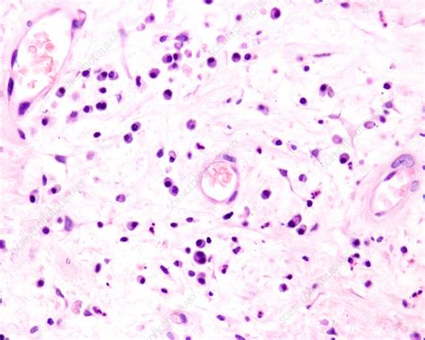 Plasma Cells Light Micrograph Stock Image C0576742 Science