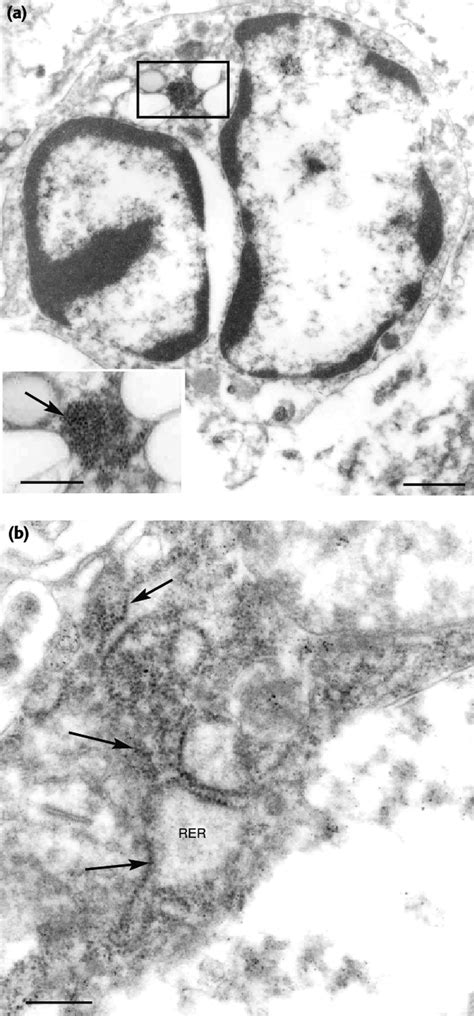 Liver Of Cat A Transmission Electron Micrographs Of A Kupffer Cell Download Scientific