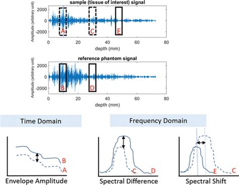 us attenuation for liver fat quantification an aium rsna qiba pulse echo quantitative
